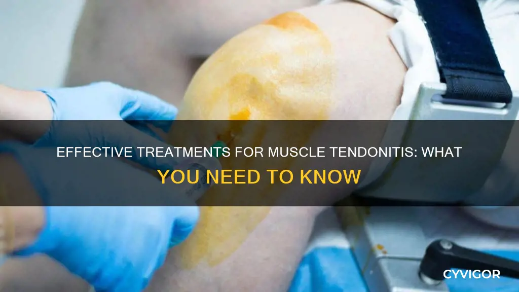 Effective Treatments For Muscle Tendonitis: What You Need To Know | CyVigor