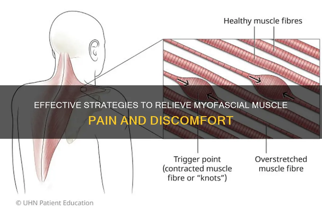 Effective Strategies To Relieve Myofascial Muscle Pain And Discomfort ...