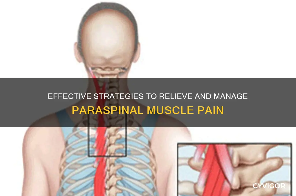 Effective Strategies To Relieve And Manage Paraspinal Muscle Pain | CyVigor