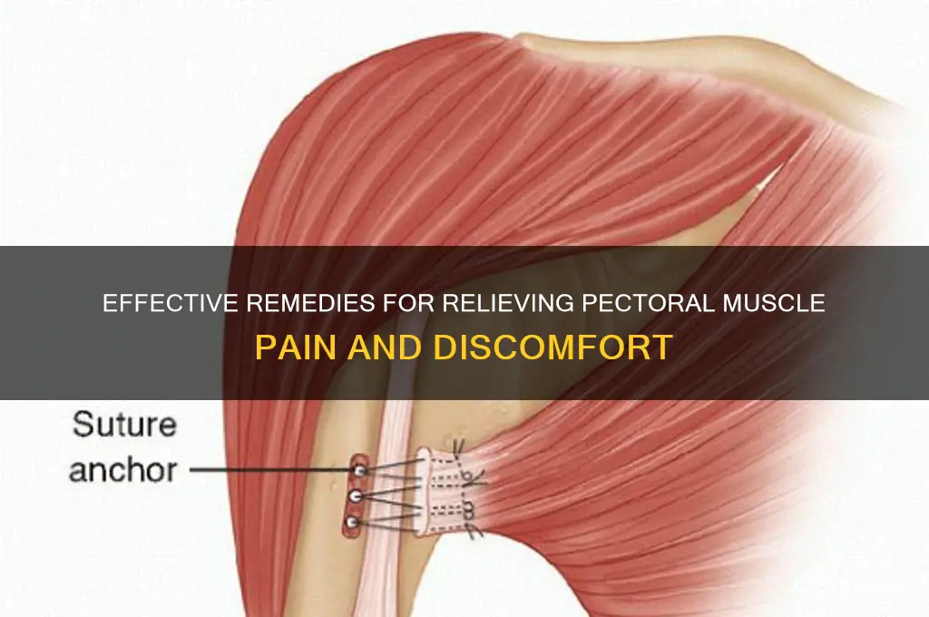 Effective Remedies For Relieving Pectoral Muscle Pain And Discomfort ...