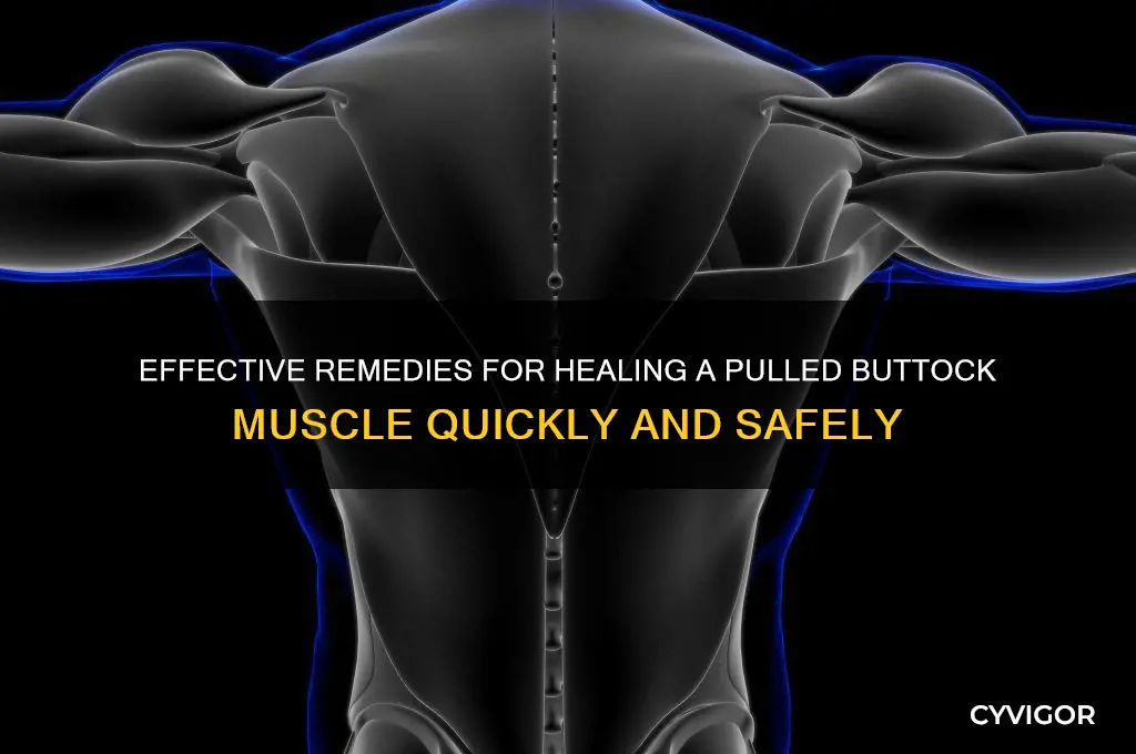 Effective Remedies For Healing A Pulled Buttock Muscle Quickly And ...