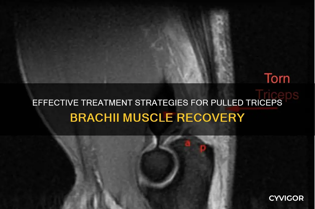 Effective Treatment Strategies For Pulled Triceps Brachii Muscle ...