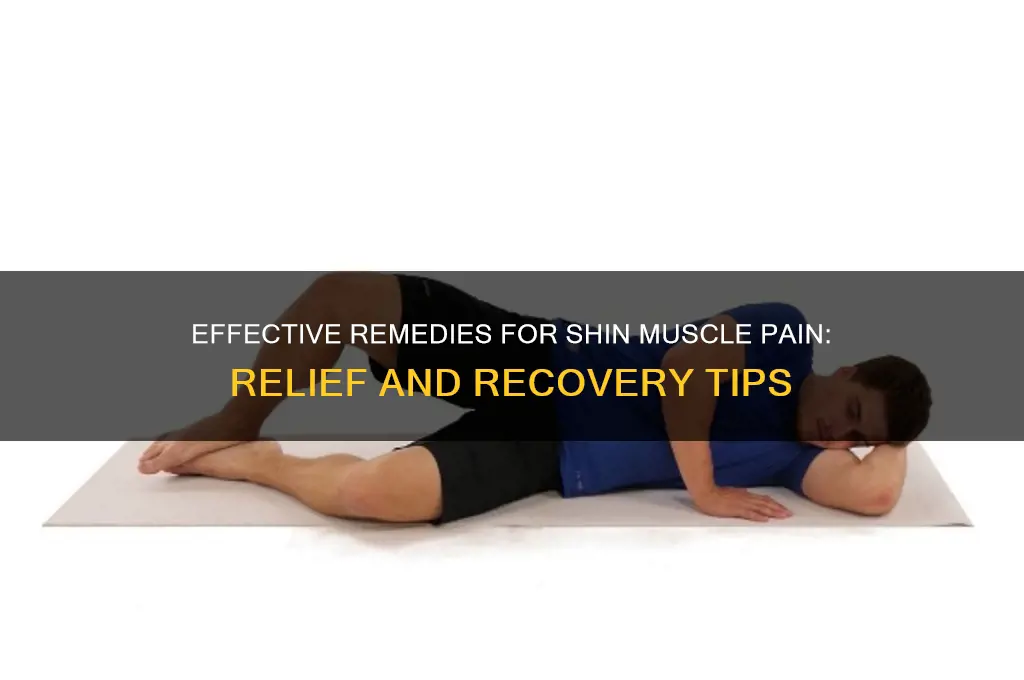 Effective Remedies For Shin Muscle Pain: Relief And Recovery Tips | CyVigor