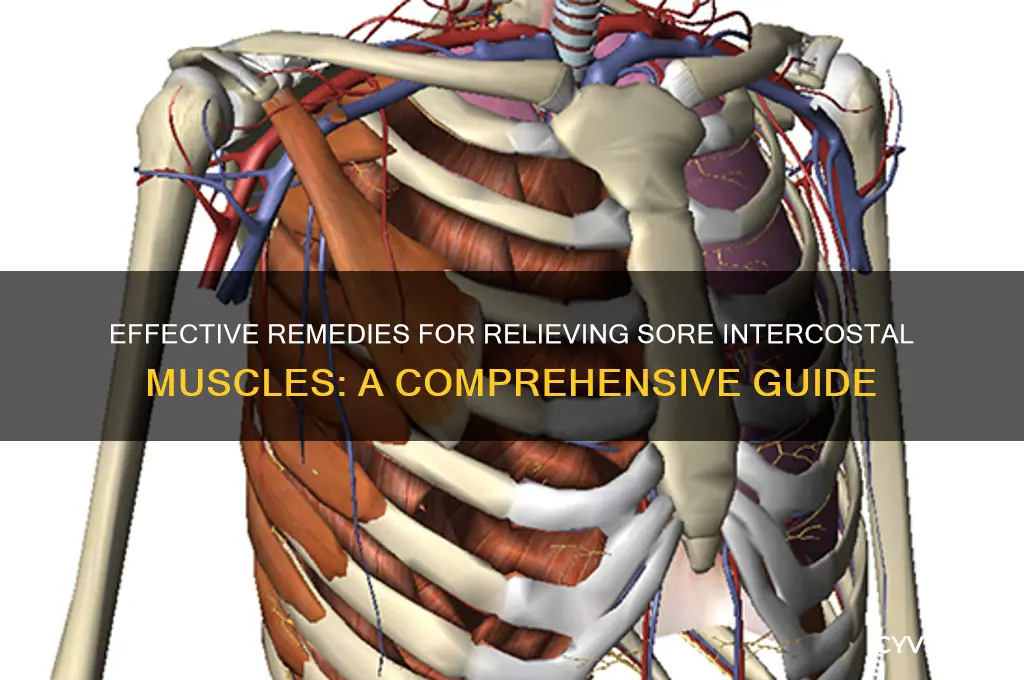 Effective Remedies For Relieving Sore Intercostal Muscles: A ...