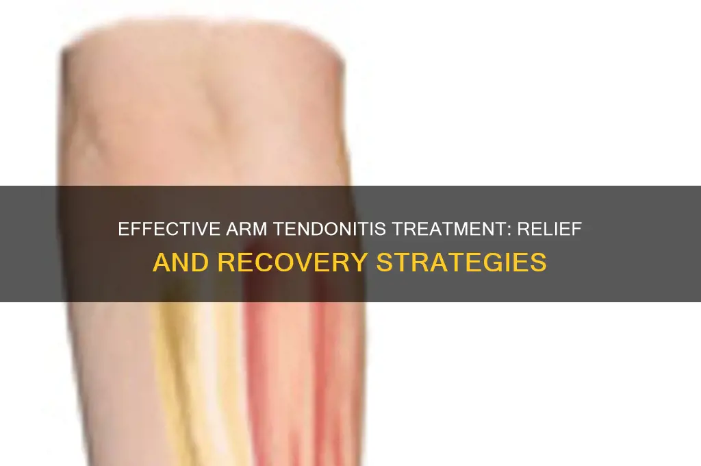 Effective Arm Tendonitis Treatment: Relief And Recovery Strategies ...