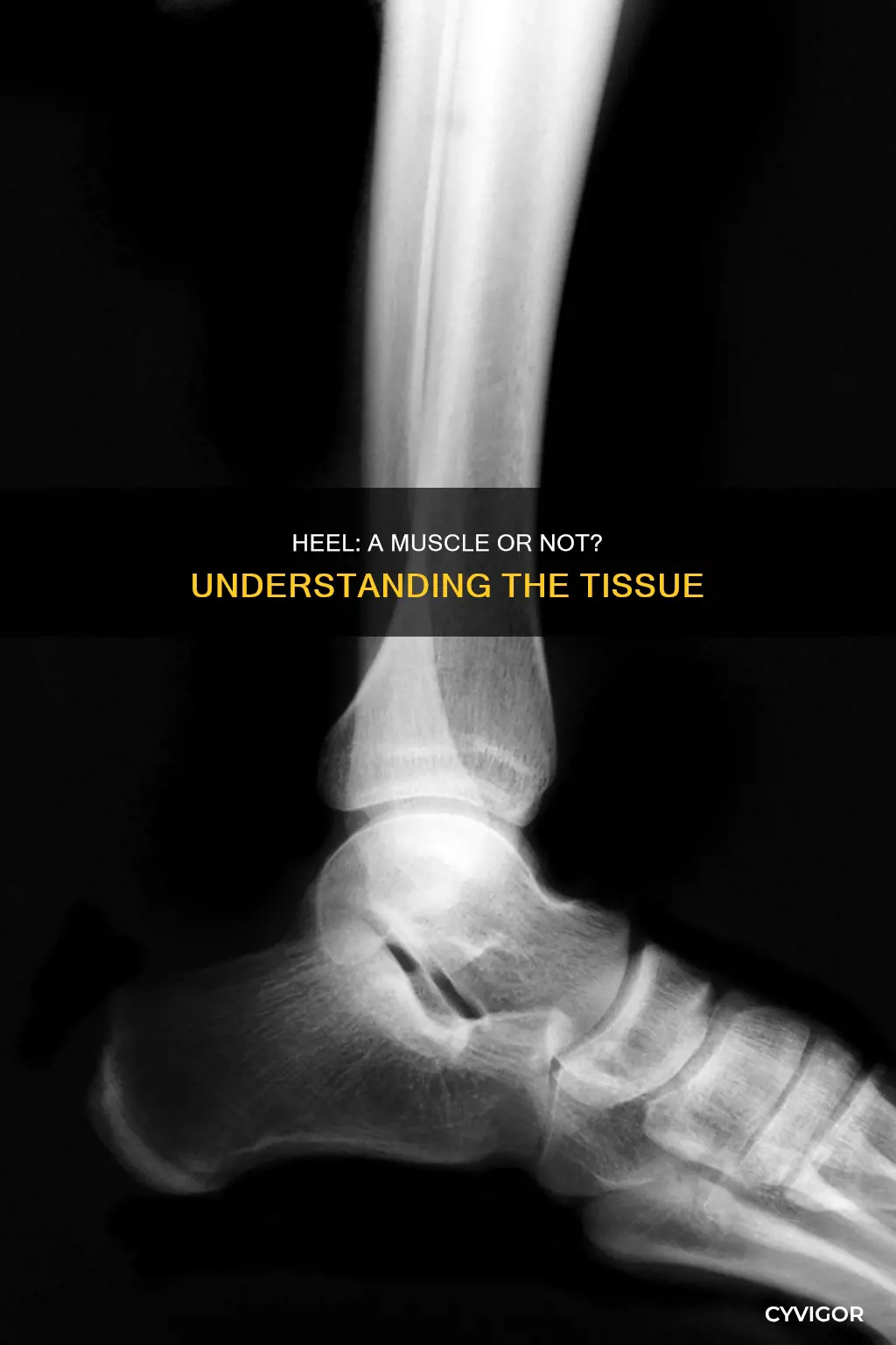 Heel: A Muscle Or Not? Understanding The Tissue | CyVigor