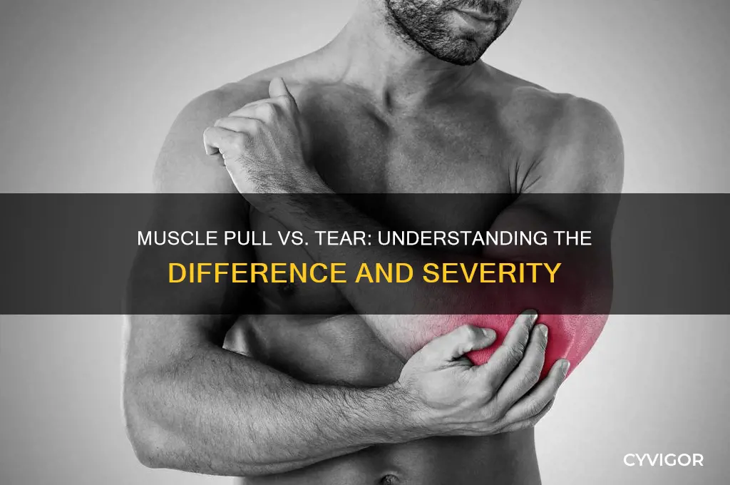Muscle Pull Vs. Tear: Understanding The Difference And Severity | CyVigor