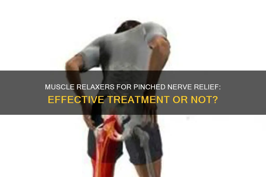 Muscle Relaxers For Pinched Nerve Relief: Effective Treatment Or Not ...