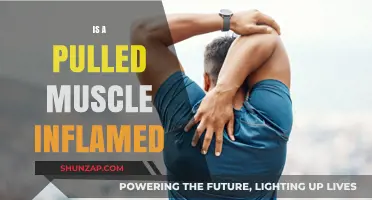 Pulled Muscle Vs. Tear: Understanding The Difference And Recovery | CyVigor