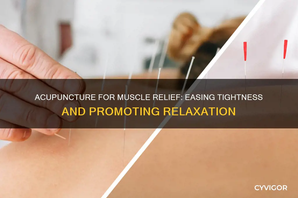 Acupuncture For Muscle Relief: Easing Tightness And Promoting ...