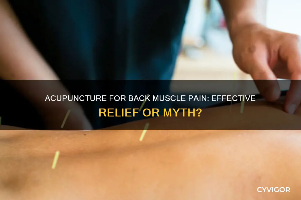 Acupuncture For Back Muscle Pain: Effective Relief Or Myth? | CyVigor