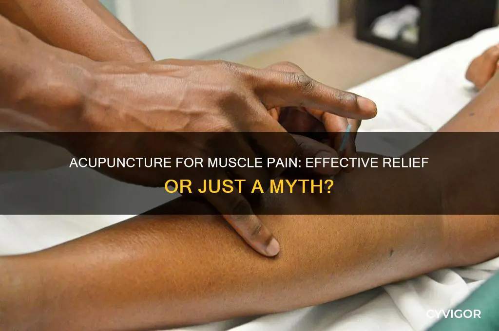 Acupuncture For Muscle Pain: Effective Relief Or Just A Myth? | CyVigor