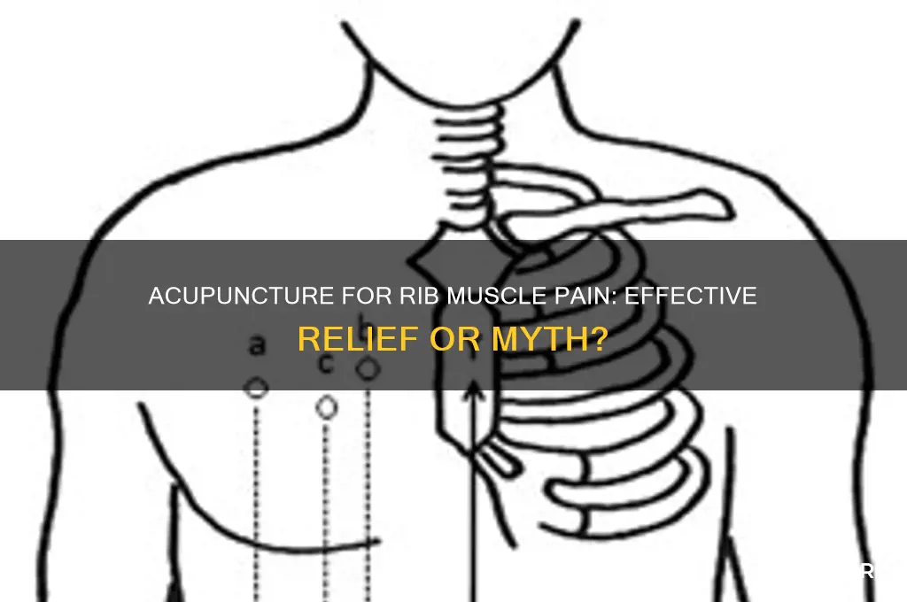 Acupuncture For Rib Muscle Pain: Effective Relief Or Myth? | CyVigor