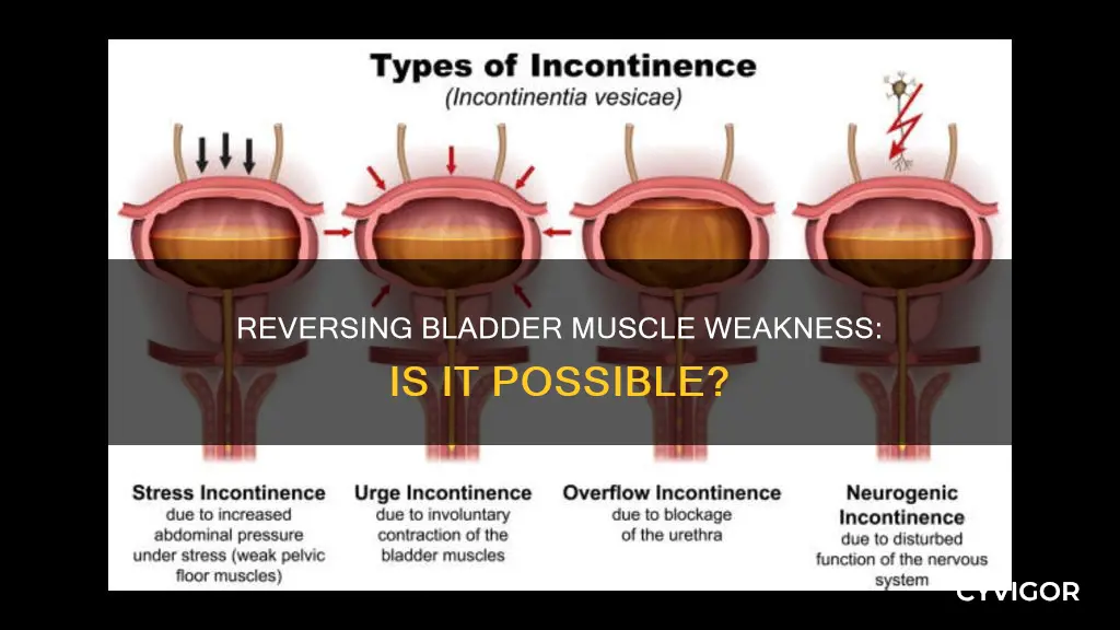 Reversing Bladder Muscle Weakness: Is It Possible? | CyVigor
