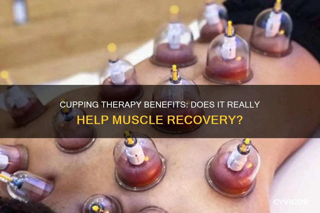 Cupping Therapy Benefits: Does It Really Help Muscle Recovery? | CyVigor