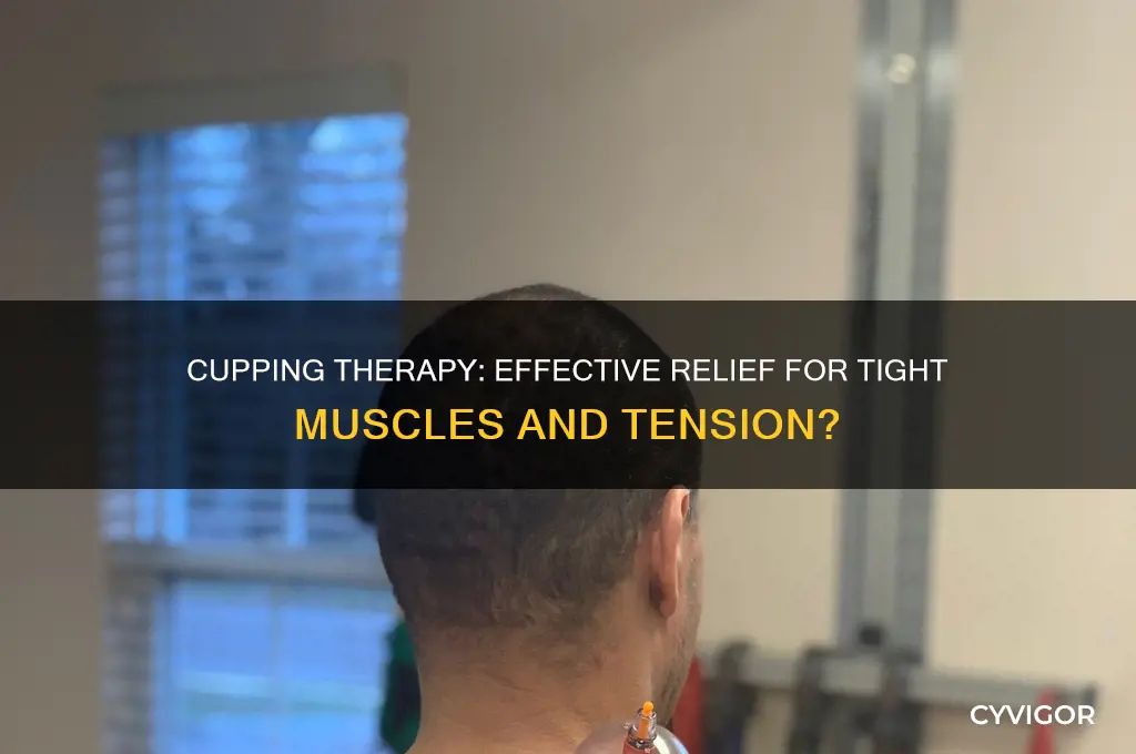 Cupping Therapy: Effective Relief For Tight Muscles And Tension? | CyVigor