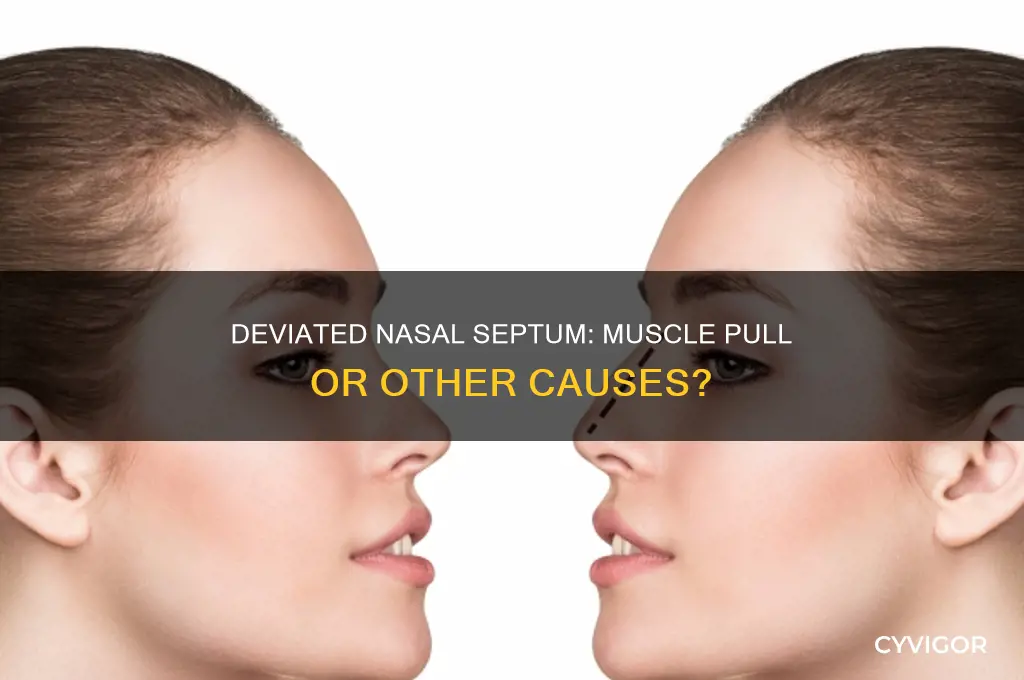 Deviated Nasal Septum: Muscle Pull Or Other Causes? | CyVigor