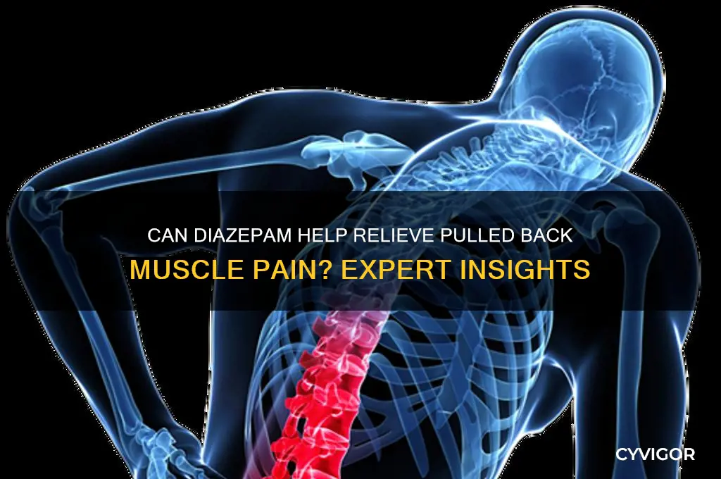 Can Diazepam Help Relieve Pulled Back Muscle Pain? Expert Insights ...