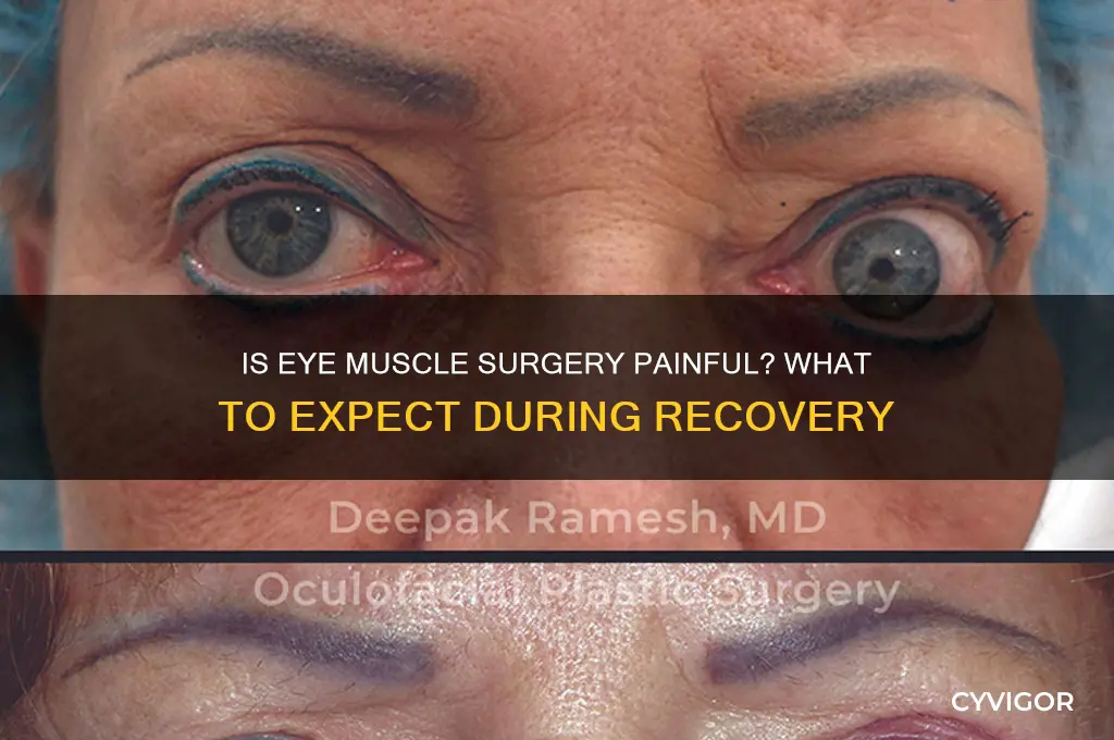 Is Eye Muscle Surgery Painful? What To Expect During Recovery | CyVigor