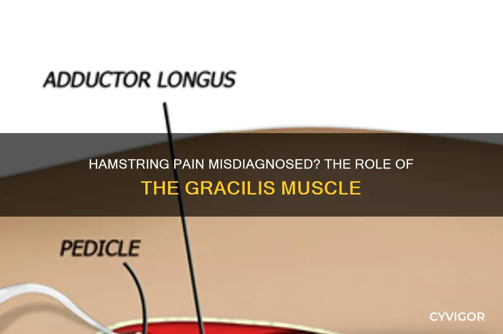 Hamstring Pain Misdiagnosed? The Role Of The Gracilis Muscle | CyVigor