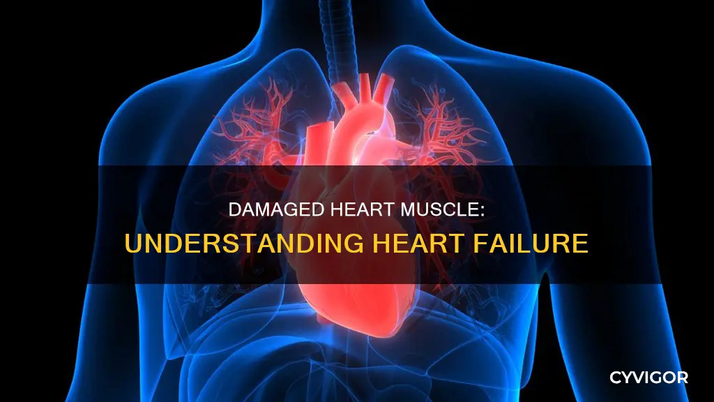 Damaged Heart Muscle: Understanding Heart Failure | CyVigor