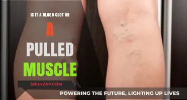 Pulled Muscle Or Liver Pain: How To Tell The Difference | CyVigor