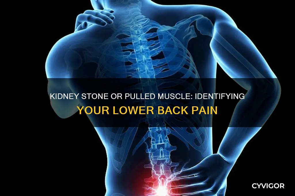 Kidney Stone Or Pulled Muscle: Identifying Your Lower Back Pain | CyVigor