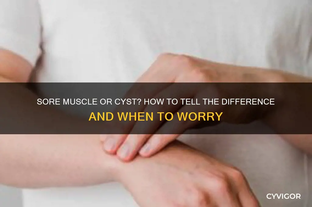 Sore Muscle Or Cyst? How To Tell The Difference And When To Worry | CyVigor