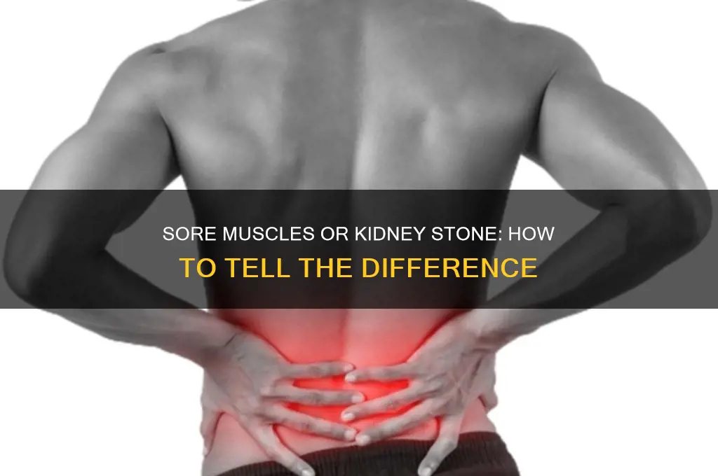 Sore Muscles Or Kidney Stone: How To Tell The Difference | CyVigor