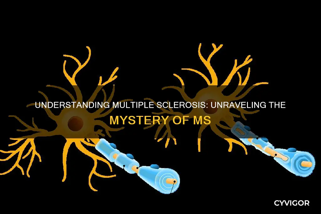 Understanding Multiple Sclerosis: Unraveling The Mystery Of Ms | CyVigor