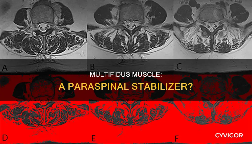Multifidus Muscle: A Paraspinal Stabilizer? | CyVigor