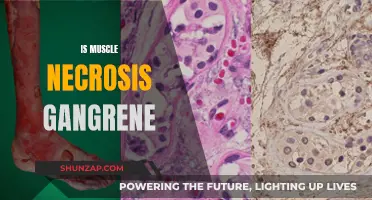 Trap Muscles: Understanding Their Function And Anatomy | CyVigor