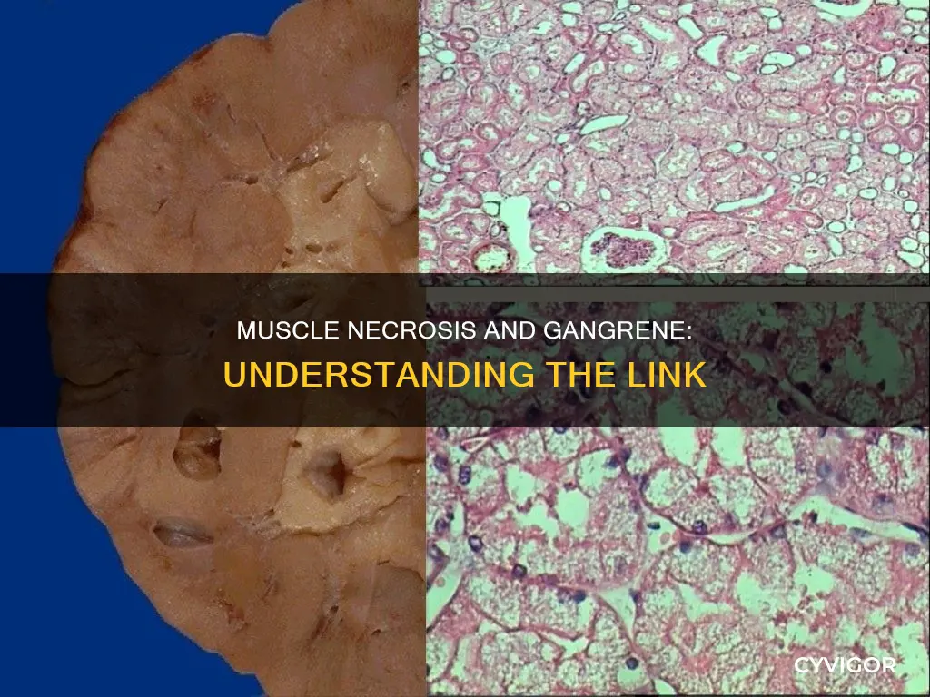 Muscle Necrosis And Gangrene: Understanding The Link | CyVigor