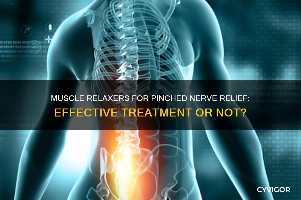 Muscle Relaxers For Pinched Nerve Relief: Effective Treatment Or Not ...