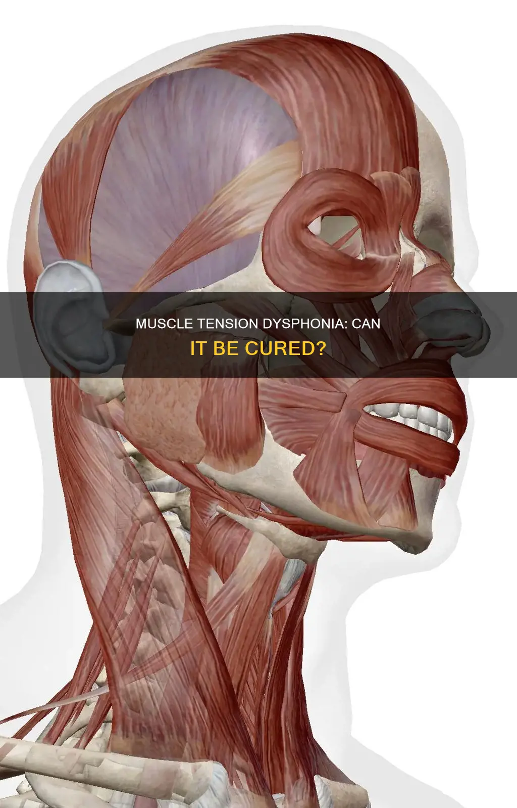 Muscle Tension Dysphonia: Can It Be Cured? | CyVigor