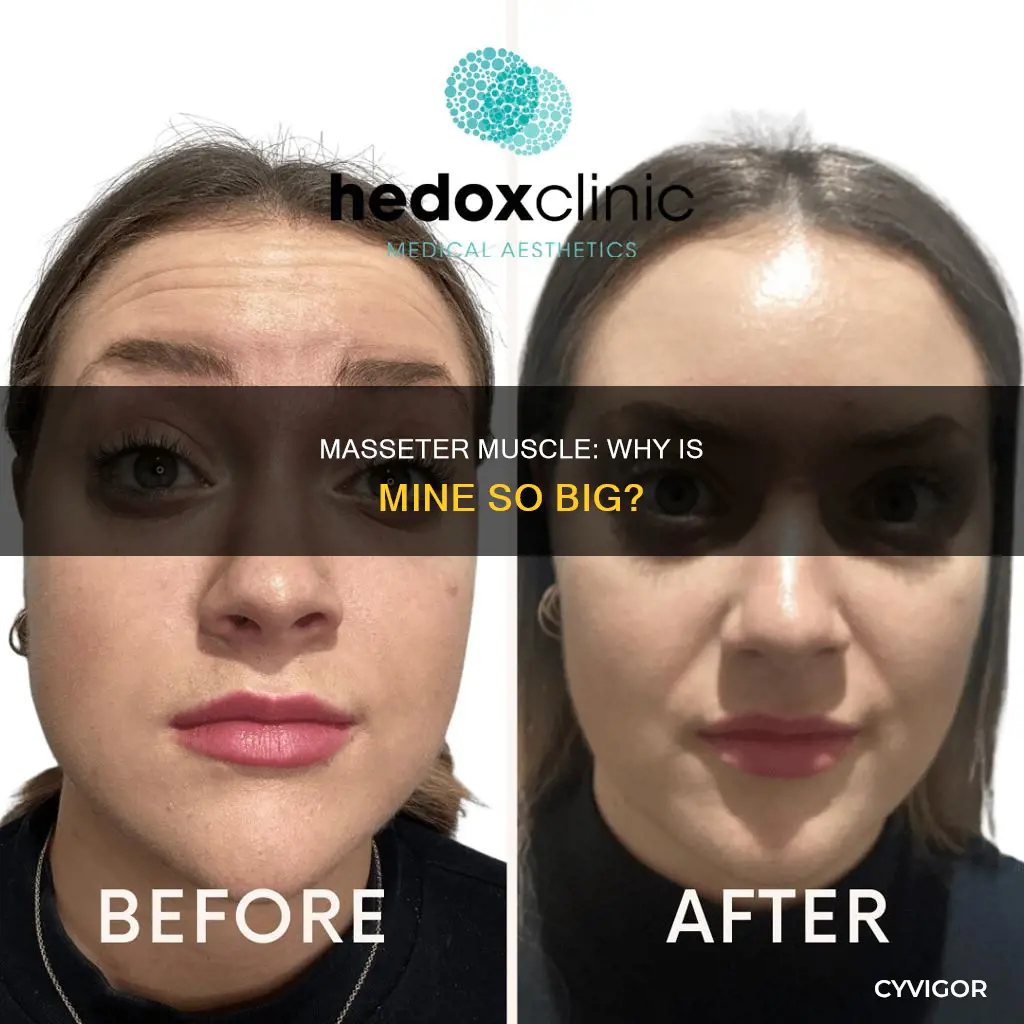 Masseter Muscle: Why Is Mine So Big? | CyVigor