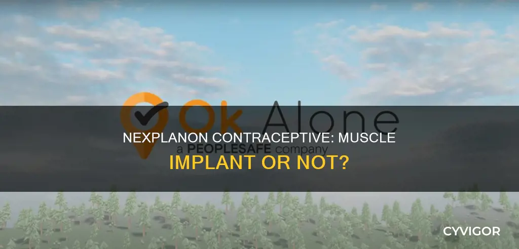 Nexplanon Contraceptive: Muscle Implant Or Not? | CyVigor