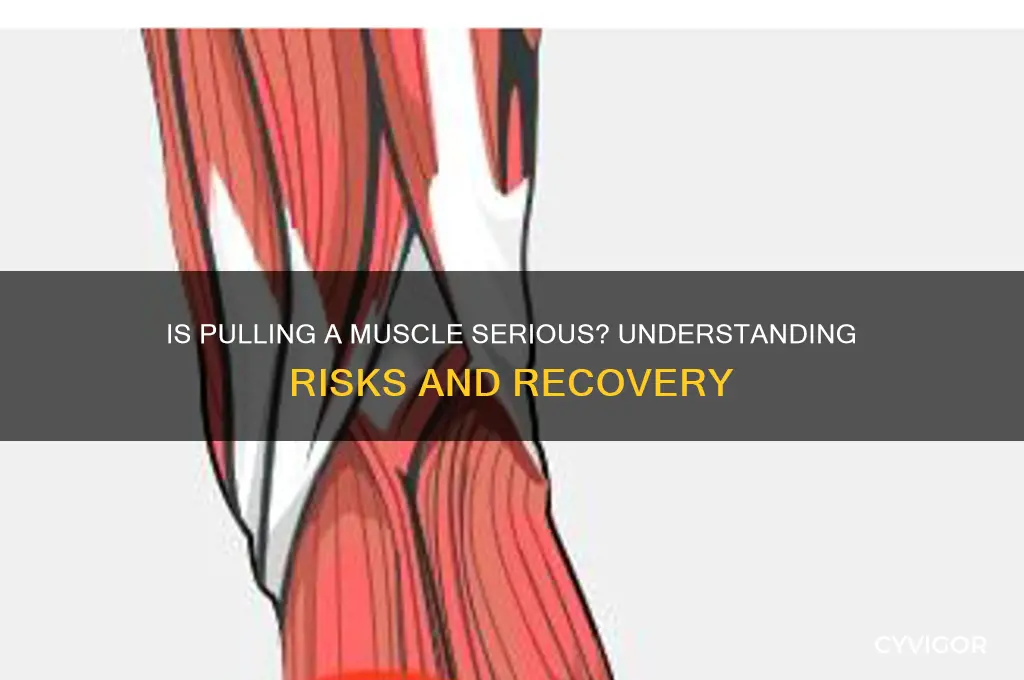 Is Pulling A Muscle Serious? Understanding Risks And Recovery | CyVigor
