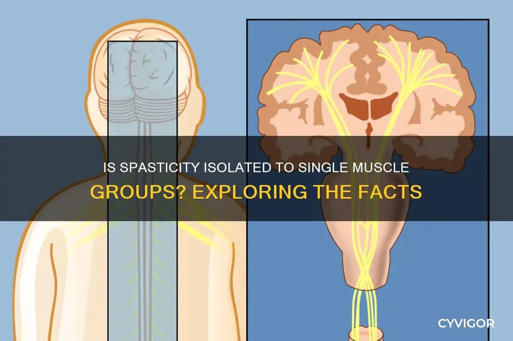 Is Spasticity Isolated To Single Muscle Groups? Exploring The Facts ...