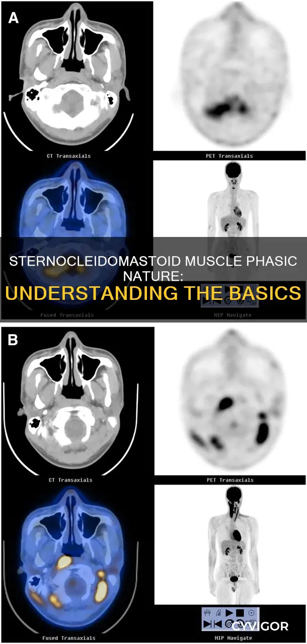 Sternocleidomastoid Muscle Phasic Nature: Understanding The Basics ...