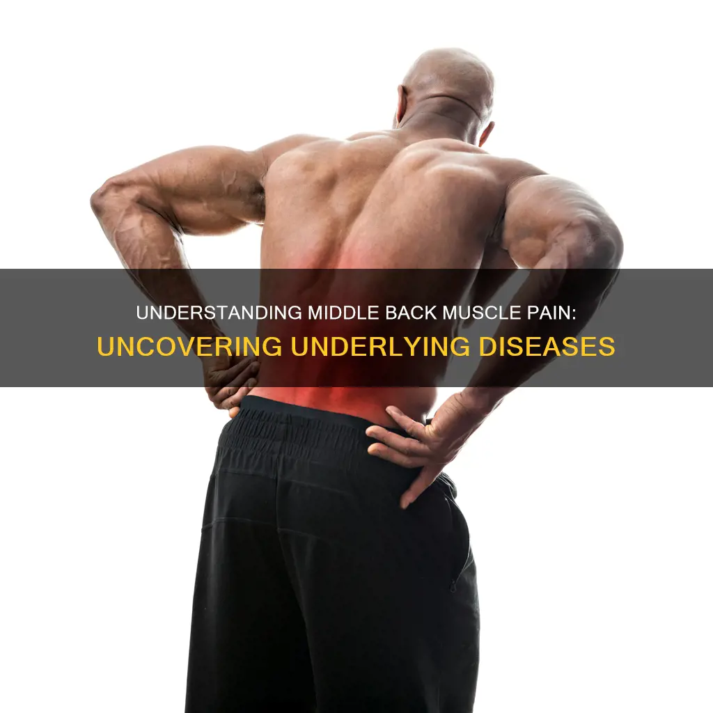 Understanding Middle Back Muscle Pain: Uncovering Underlying Diseases ...