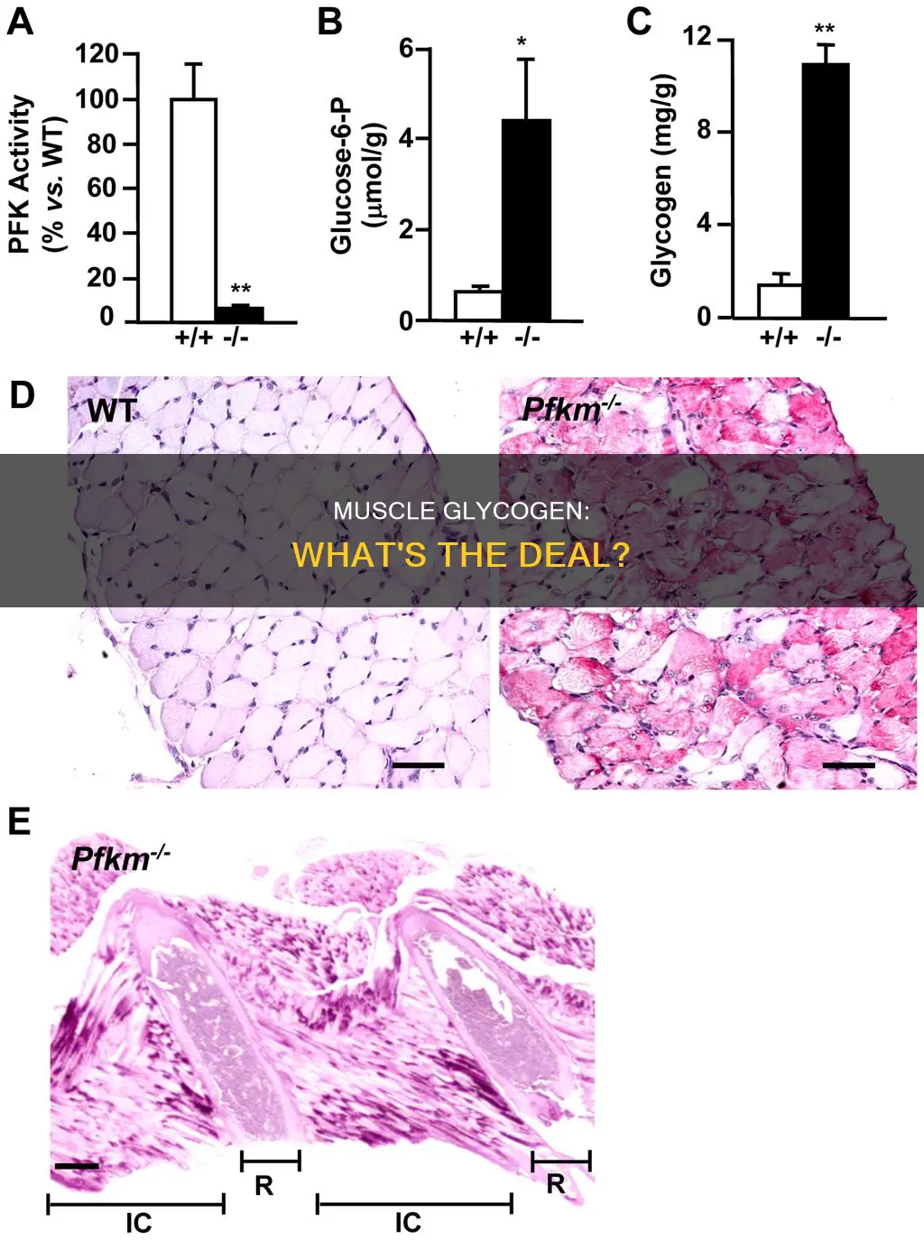 Muscle Glycogen: What's The Deal? | CyVigor