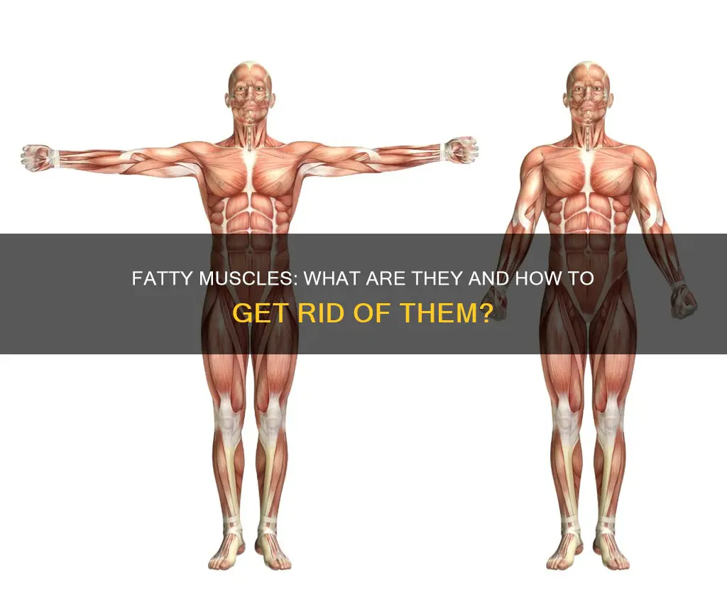Fatty Muscles: What Are They And How To Get Rid Of Them? | CyVigor