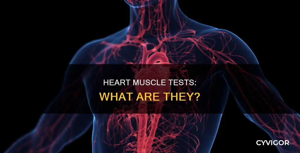 Heart Muscle Tests: What Are They? | CyVigor