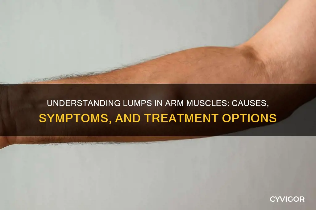 Understanding Lumps In Arm Muscles: Causes, Symptoms, And Treatment ...