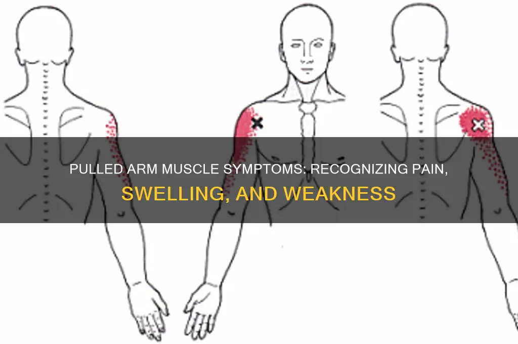 Pulled Arm Muscle Symptoms: Recognizing Pain, Swelling, And Weakness ...