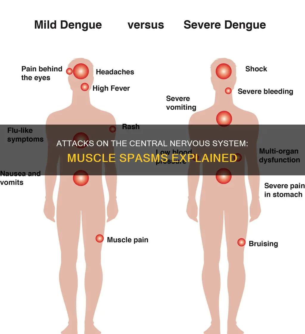 Attacks On The Central Nervous System: Muscle Spasms Explained | CyVigor