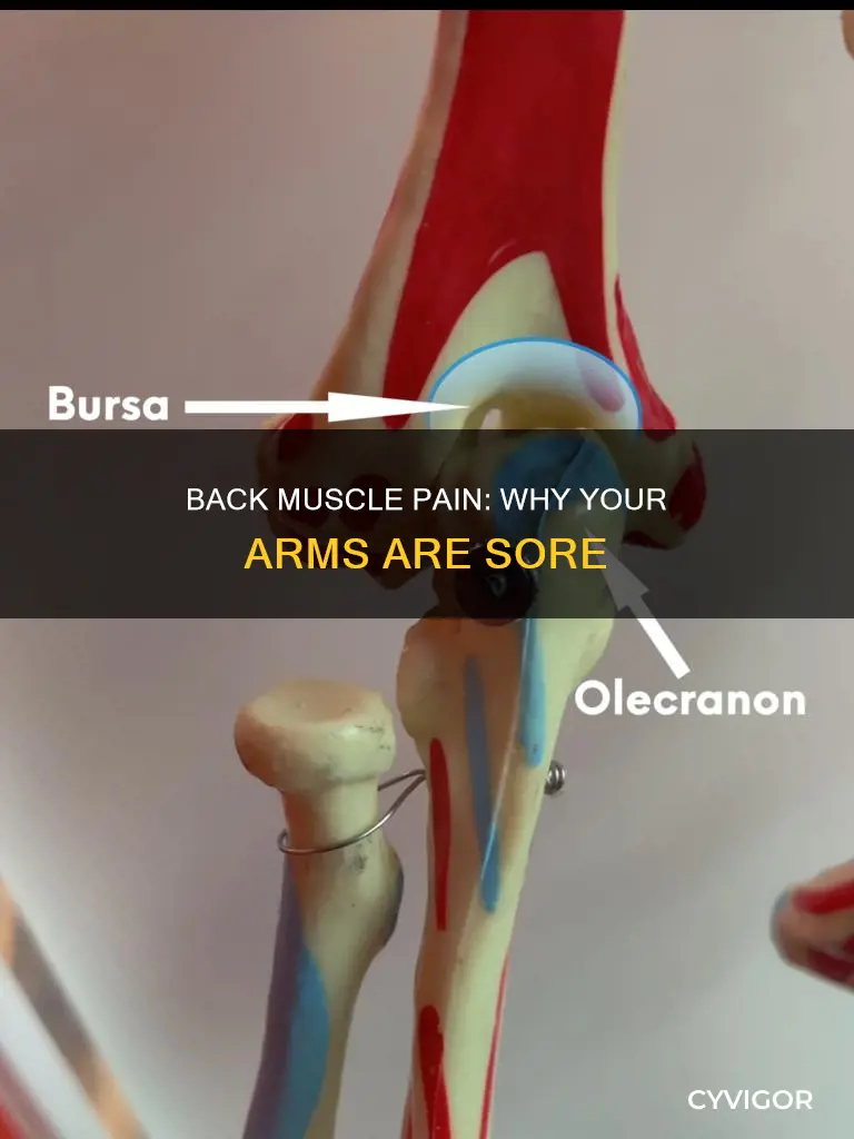 Back Muscle Pain: Why Your Arms Are Sore | CyVigor