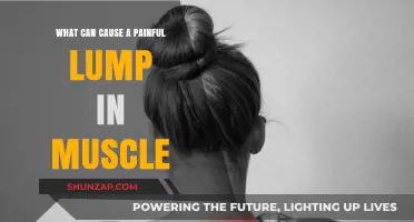 Muscle Pull Causes: Understanding The Reasons Behind The Pain | CyVigor