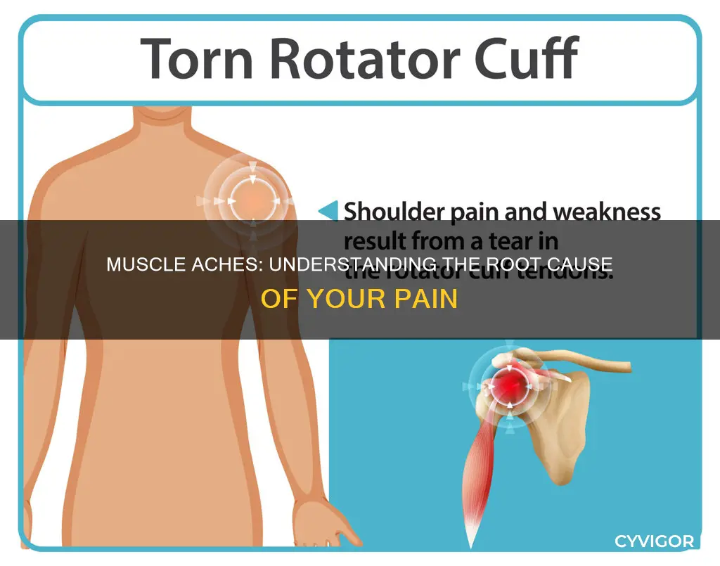Muscle Aches: Understanding The Root Cause Of Your Pain | CyVigor
